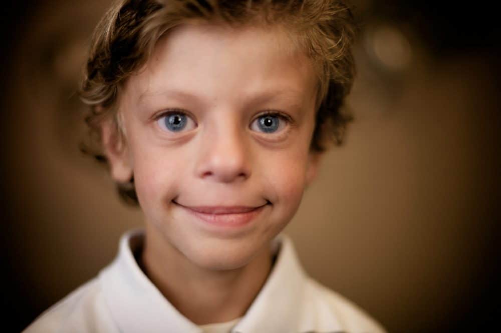 Síndrome de Williams: Un trastorno que hace que los niños quieran a ...